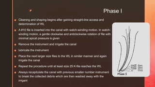 Step-back technique of root canal preparation.pptx