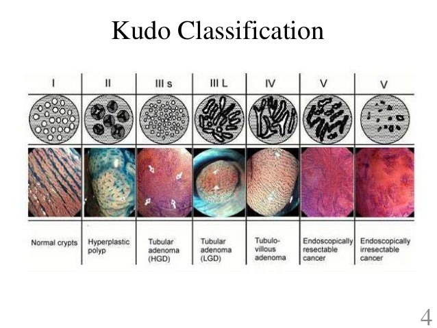 Dmitry Stepanov - Detector of interest point from region of interest