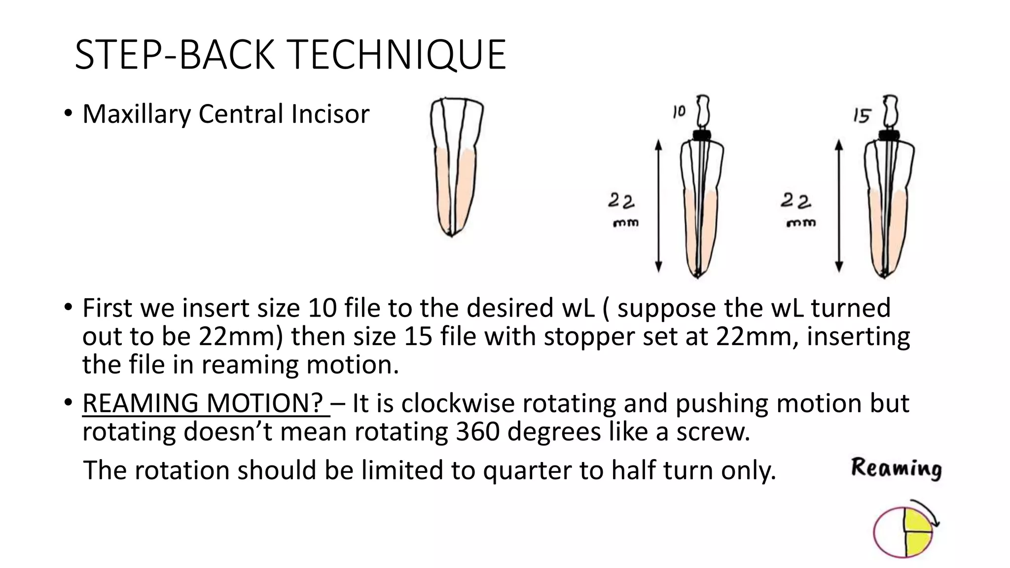 StepBackVsCrownDown.pptx