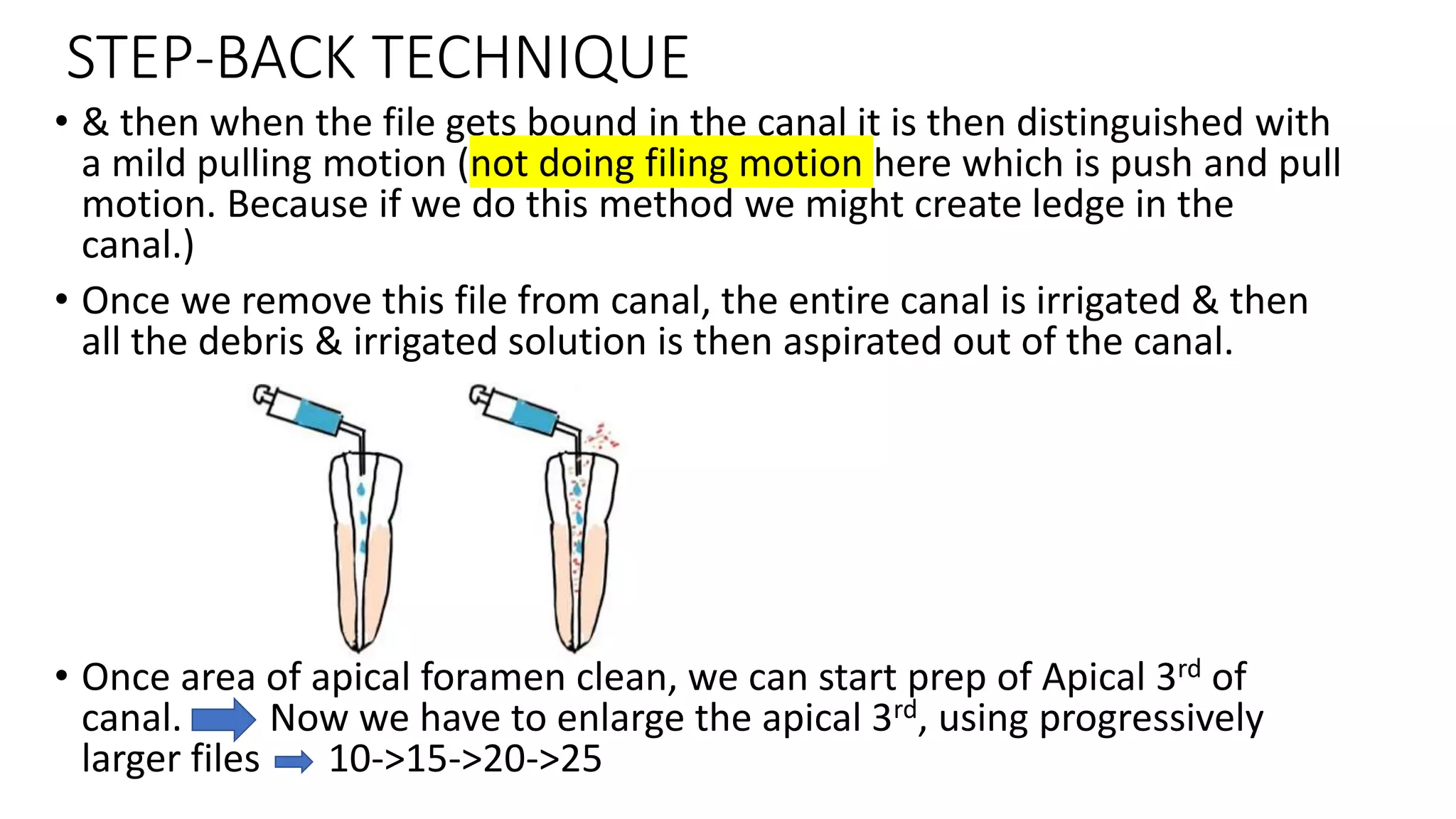 StepBackVsCrownDown.pptx