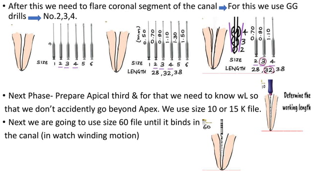 StepBackVsCrownDown.pptx | Dental Health | Diseases and Conditions