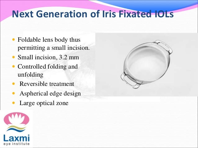 Step by step IRIS clip