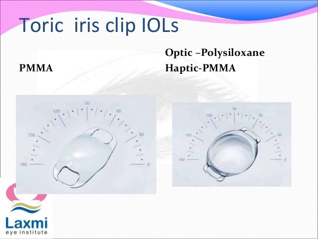 Step by step IRIS clip