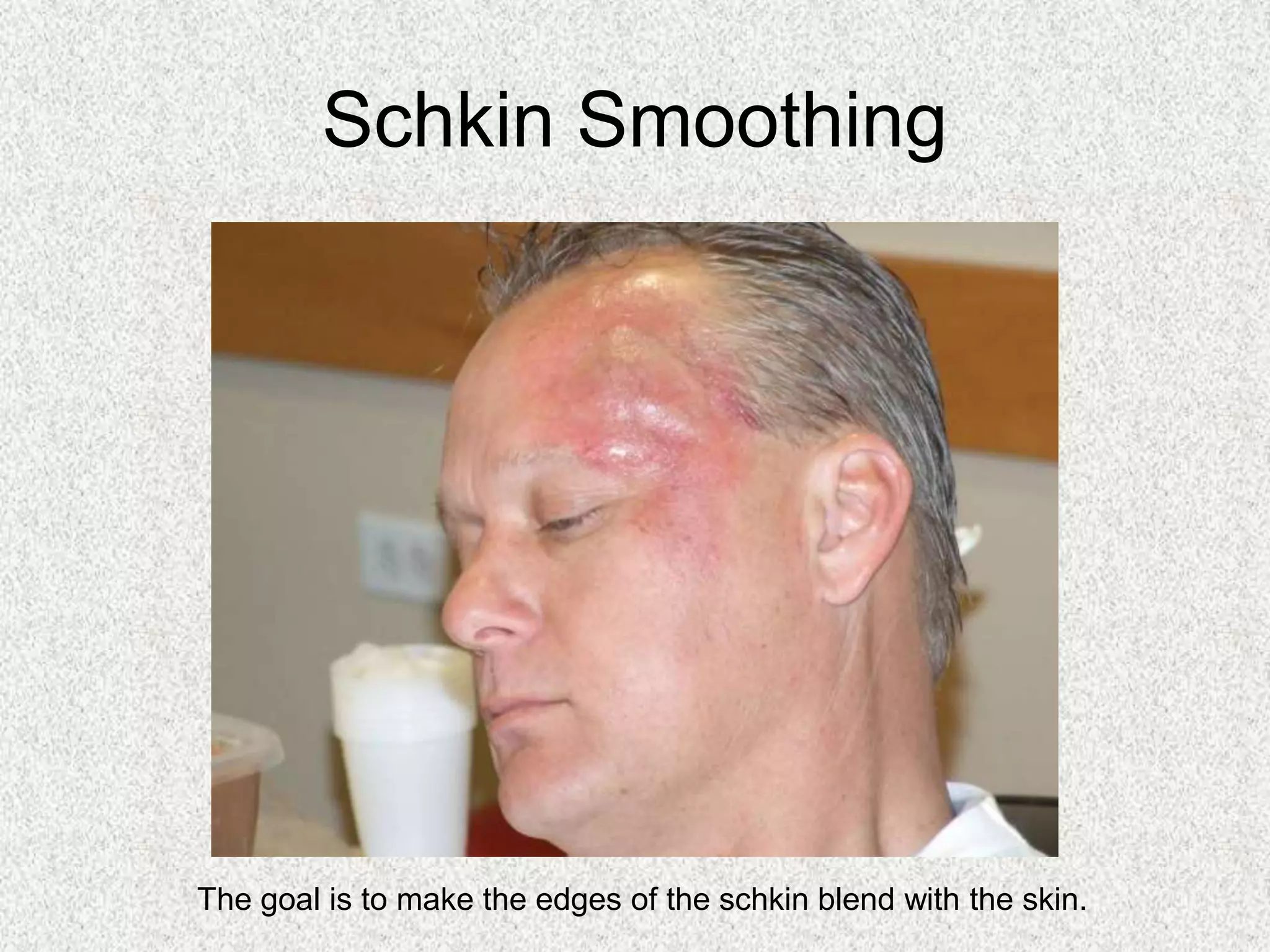 Step by step moulage | PPT