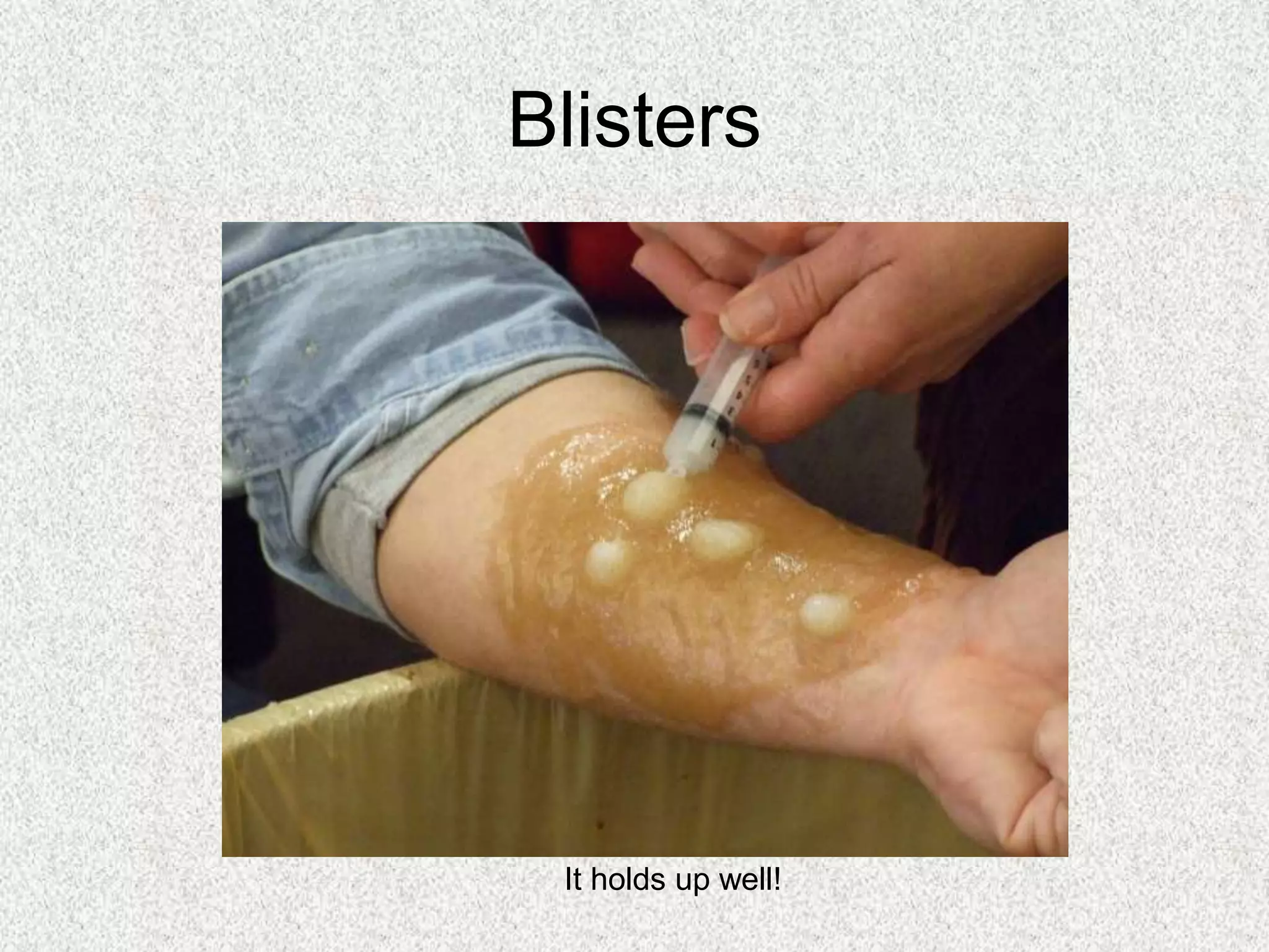 Step by step moulage | PPT