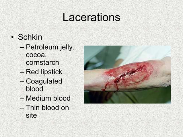 Step by step moulage | PPT