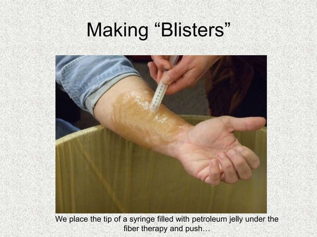 Step by step moulage | PPT | First Aid | Injuries