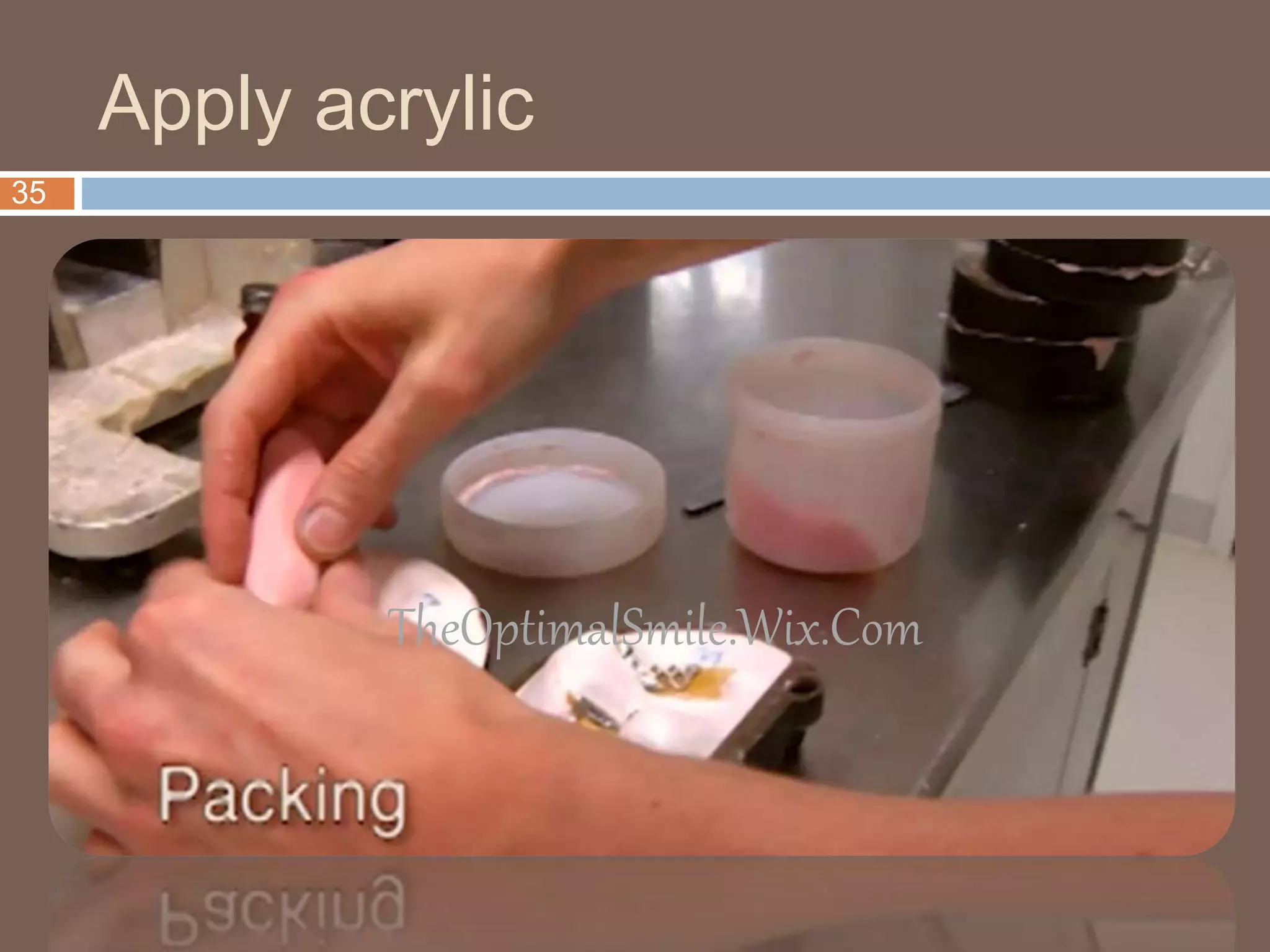 Removeable Partial Denture Steps cobalt chromium | PPSX