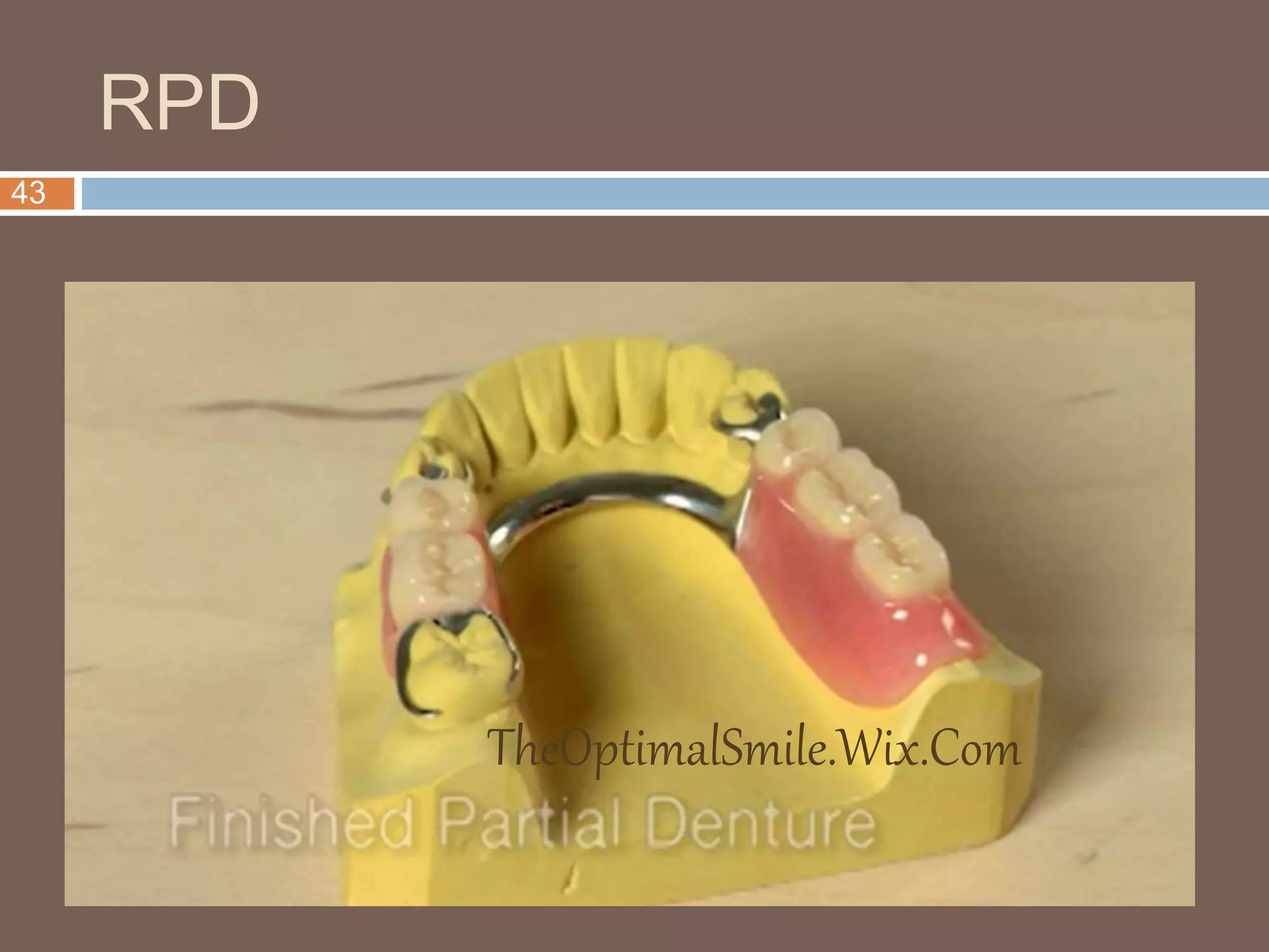 Removeable Partial Denture Steps cobalt chromium | PPSX