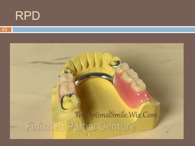 Removeable Partial Denture Steps cobalt chromium | PPSX