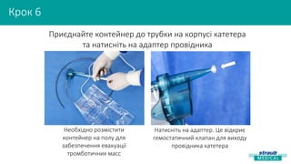 Механічна тромбоектомія з Rotarex®S | PPTX