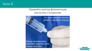 Механічна тромбоектомія з Rotarex®S | PPTX