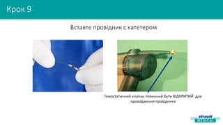 Механічна тромбоектомія з Rotarex®S | PPTX