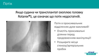 Механічна тромбоектомія з Rotarex®S | PPTX