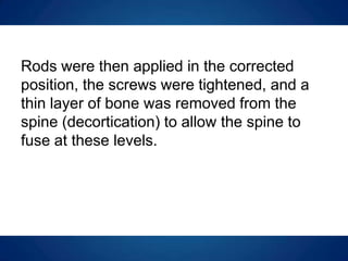 Stephanie: Severe Idiopathic Scoliosis Case Study | PPTX