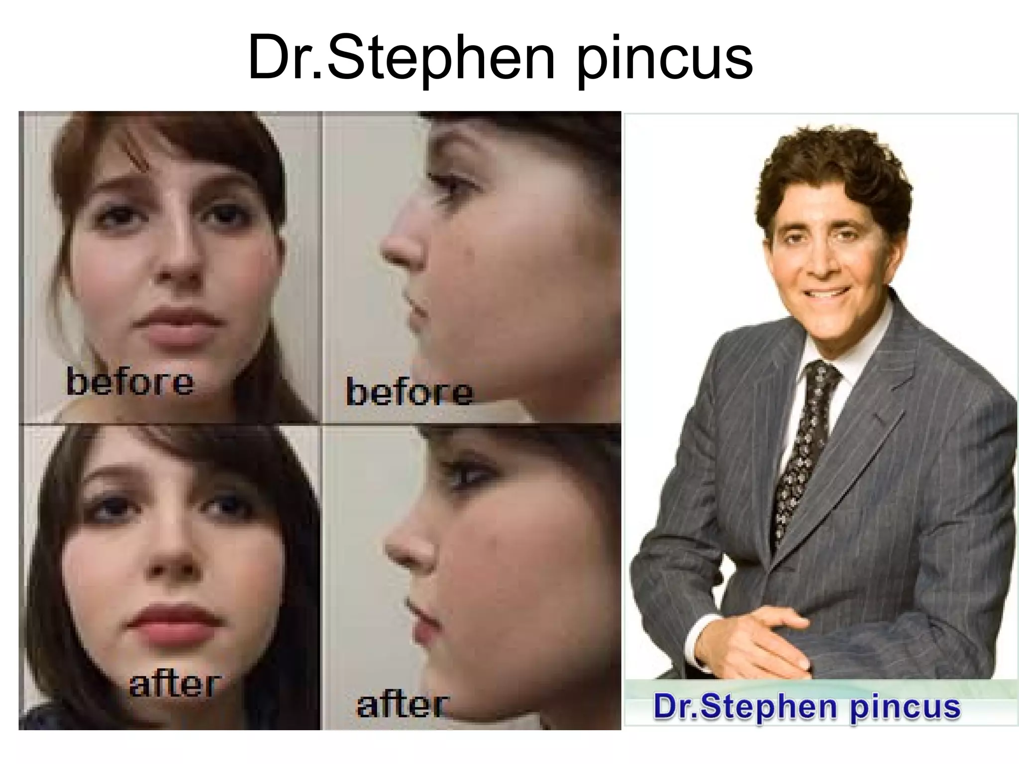 Stephen pincus | PDF