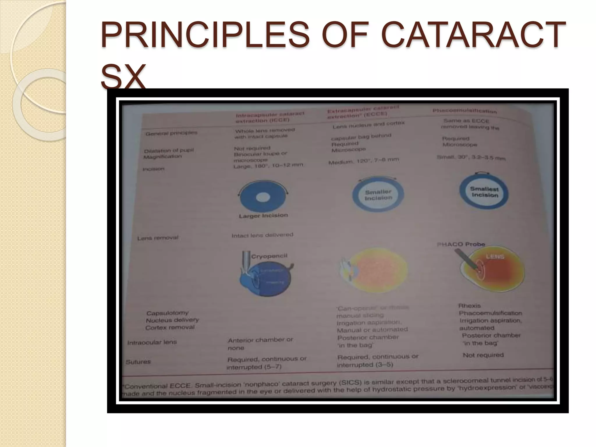 STEPS AND COMPLICATIONS OF CATARACT SURGERY.pptx