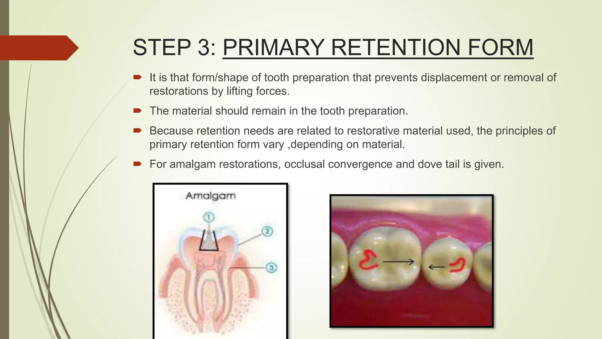 Steps of Tooth preparation (in brief) | PPTX