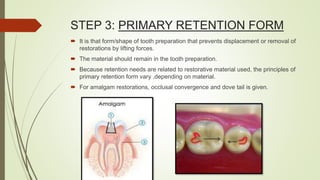 Steps of Tooth preparation (in brief) | PPTX