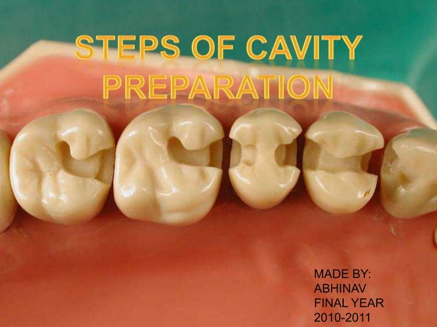 Steps Of Cavity Preparation | PPTX | Dental Health | Diseases and ...