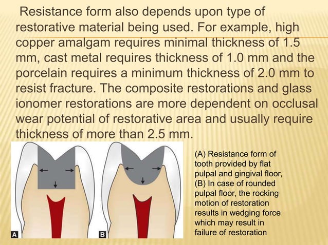 Steps Of Cavity Preparation | PPTX | Dental Health | Diseases and ...