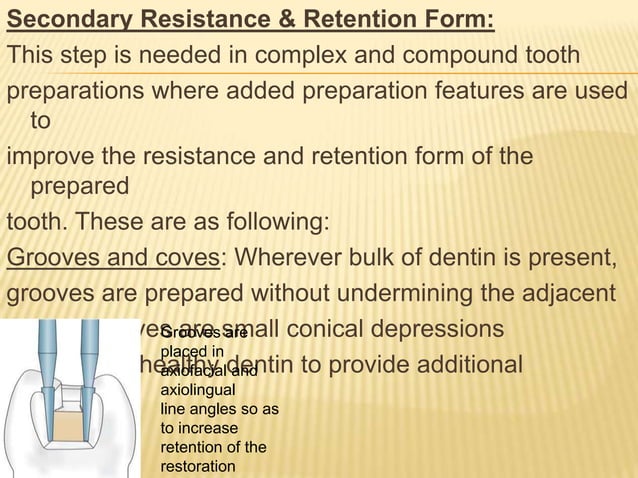 Steps Of Cavity Preparation | PPTX | Dental Health | Diseases and ...