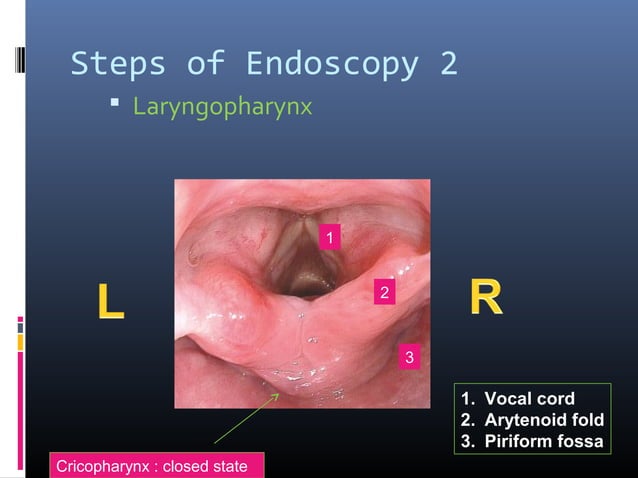 Steps of diagnostic endoscopy | PPT | Ear, Nose and Throat Conditions ...