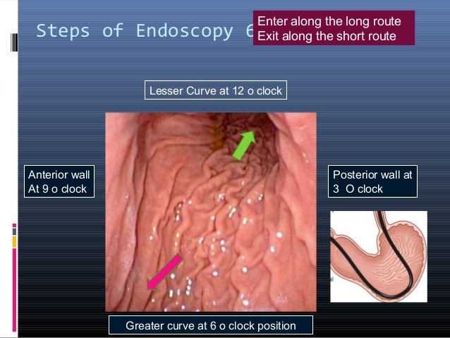 Steps of diagnostic endoscopy