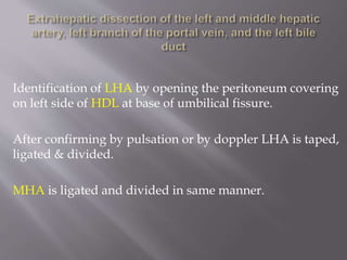 Steps of left hepatectomy.dr quiyum | PPTX