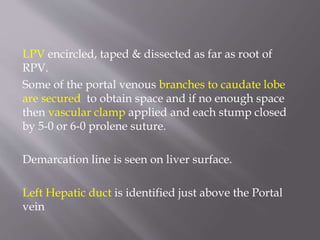 Steps of left hepatectomy.dr quiyum | PPTX