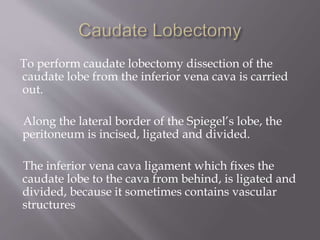 Steps of left hepatectomy.dr quiyum | PPTX