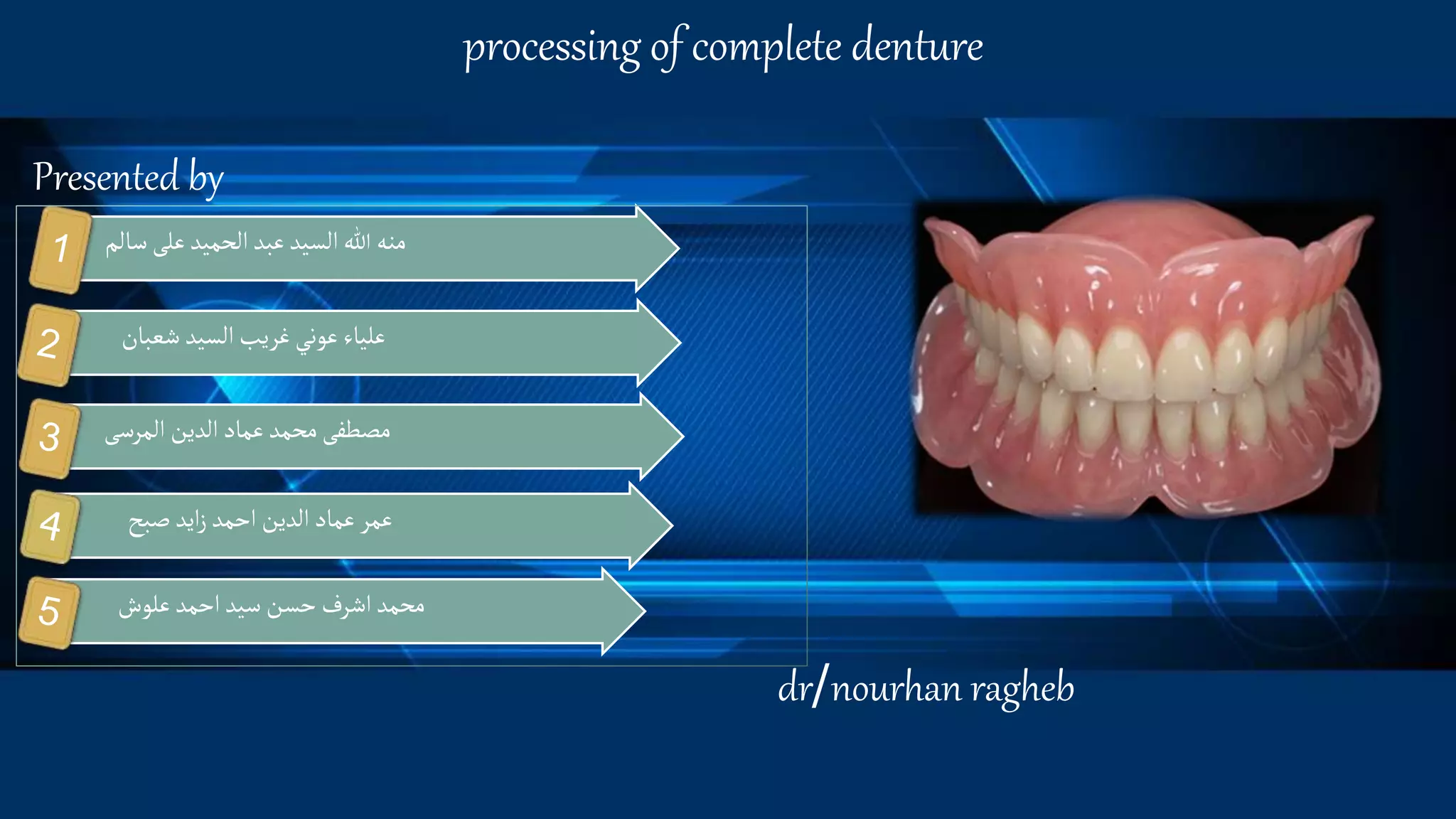 steps of processing of complete denture (2).pptx