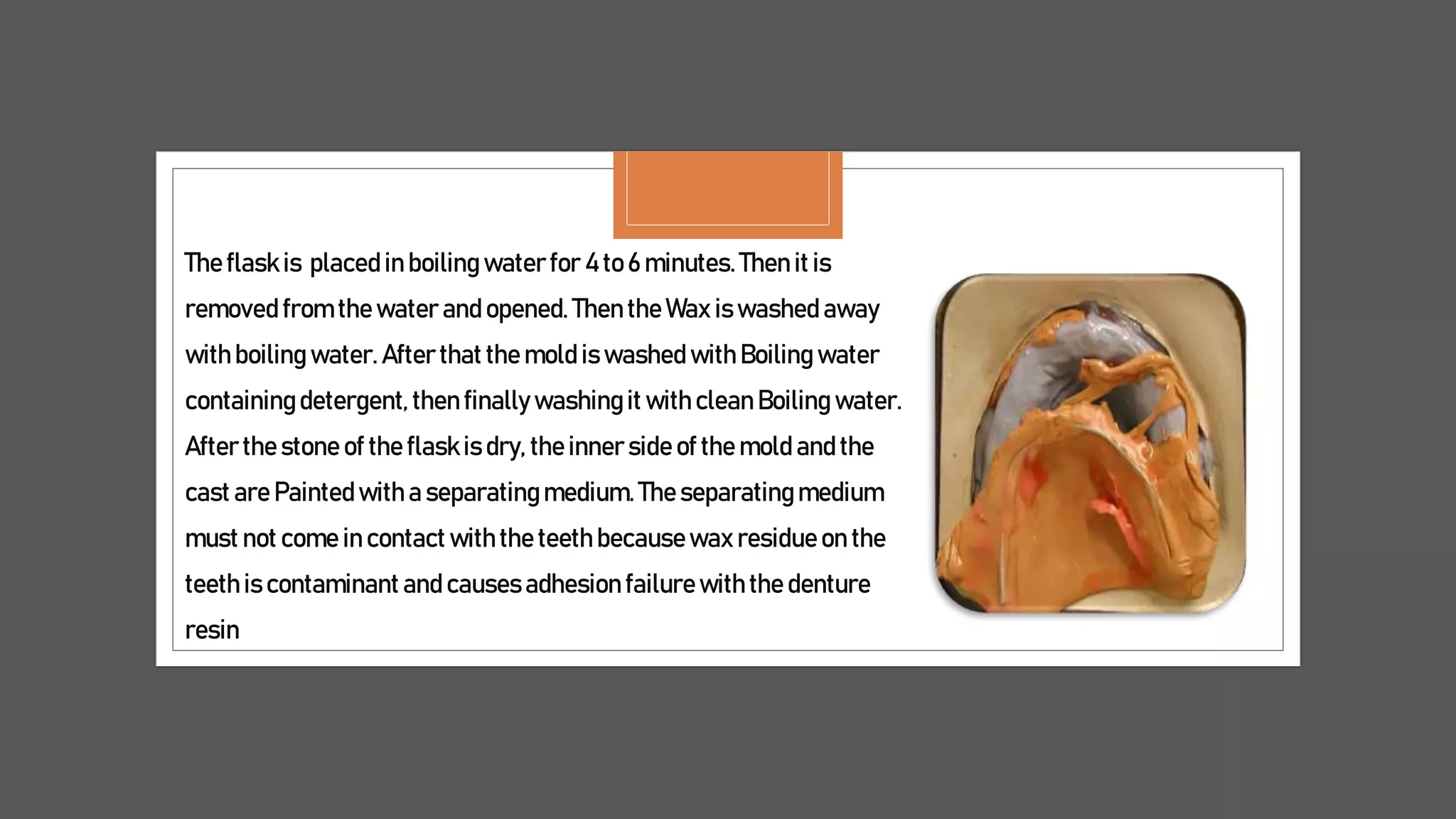 steps of processing of complete denture (2).pptx