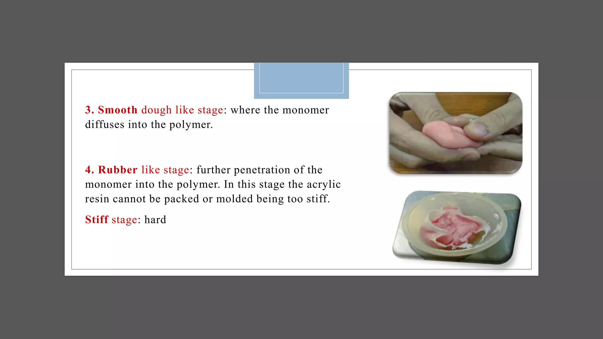 steps of processing of complete denture (2).pptx