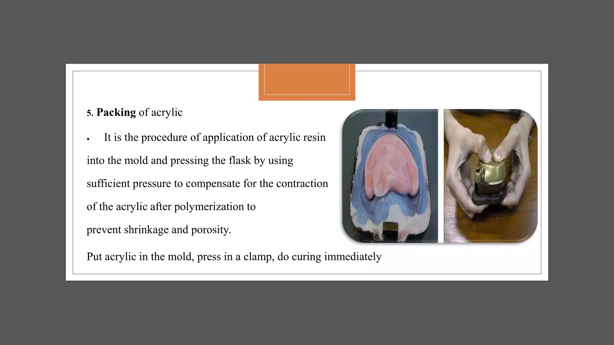 steps of processing of complete denture (2).pptx