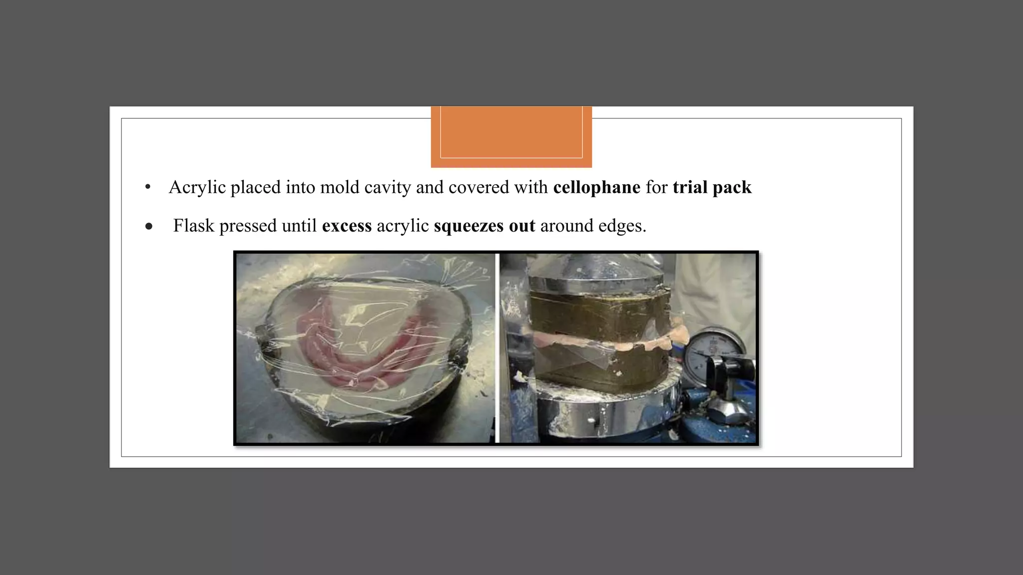 steps of processing of complete denture (2).pptx