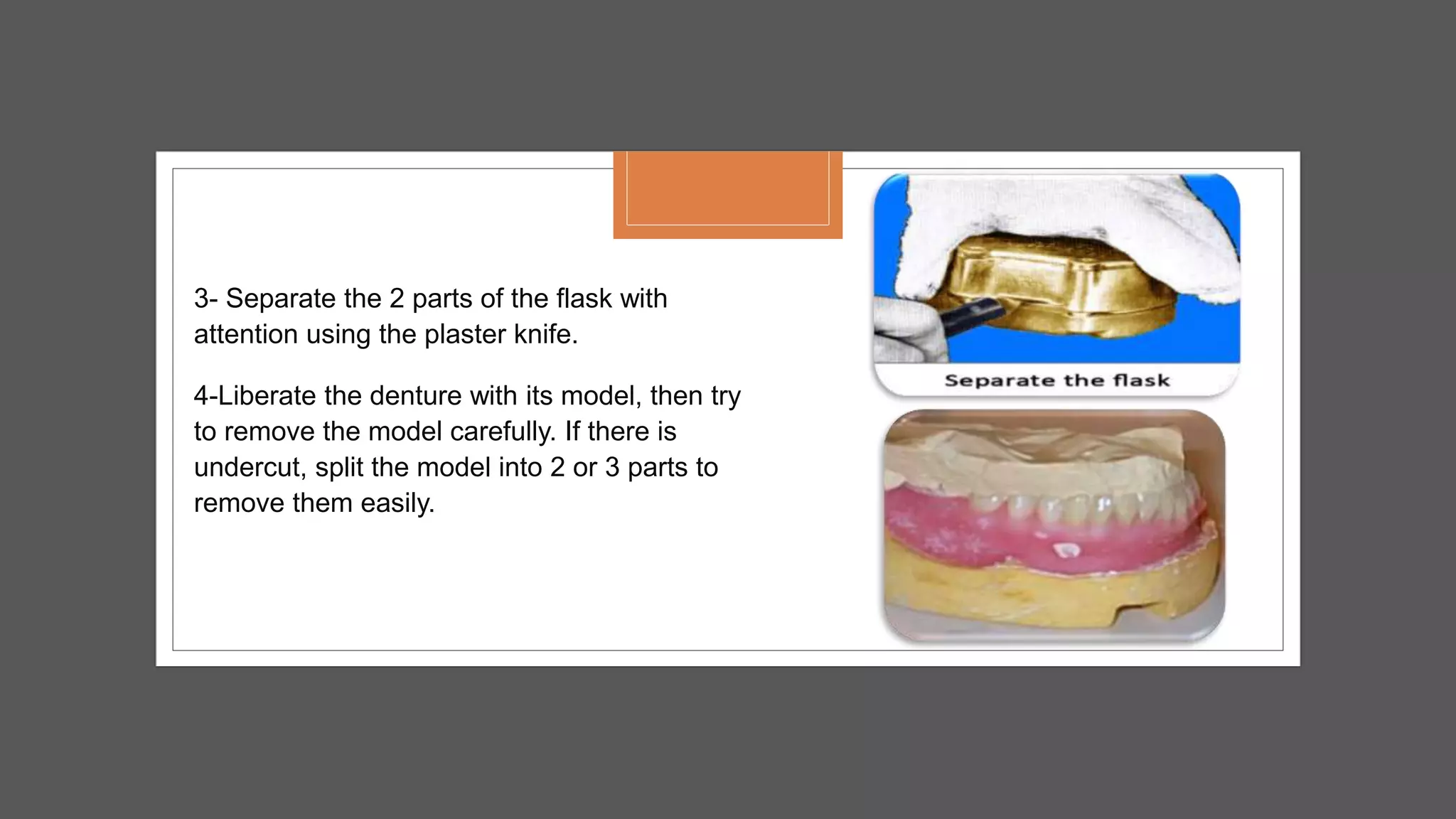 steps of processing of complete denture (2).pptx