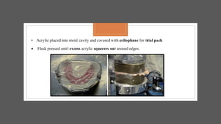 steps of processing of complete denture (2).pptx