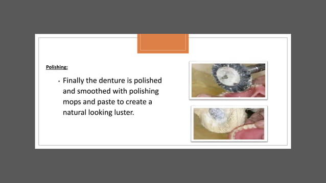 steps of processing of complete denture (2).pptx | Oral care | Personal Care