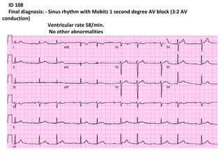 Stepwise interpretation of ECG ID108 | PPT