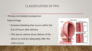 stepwisepelvicdevascularisation-180120130719.pptx
