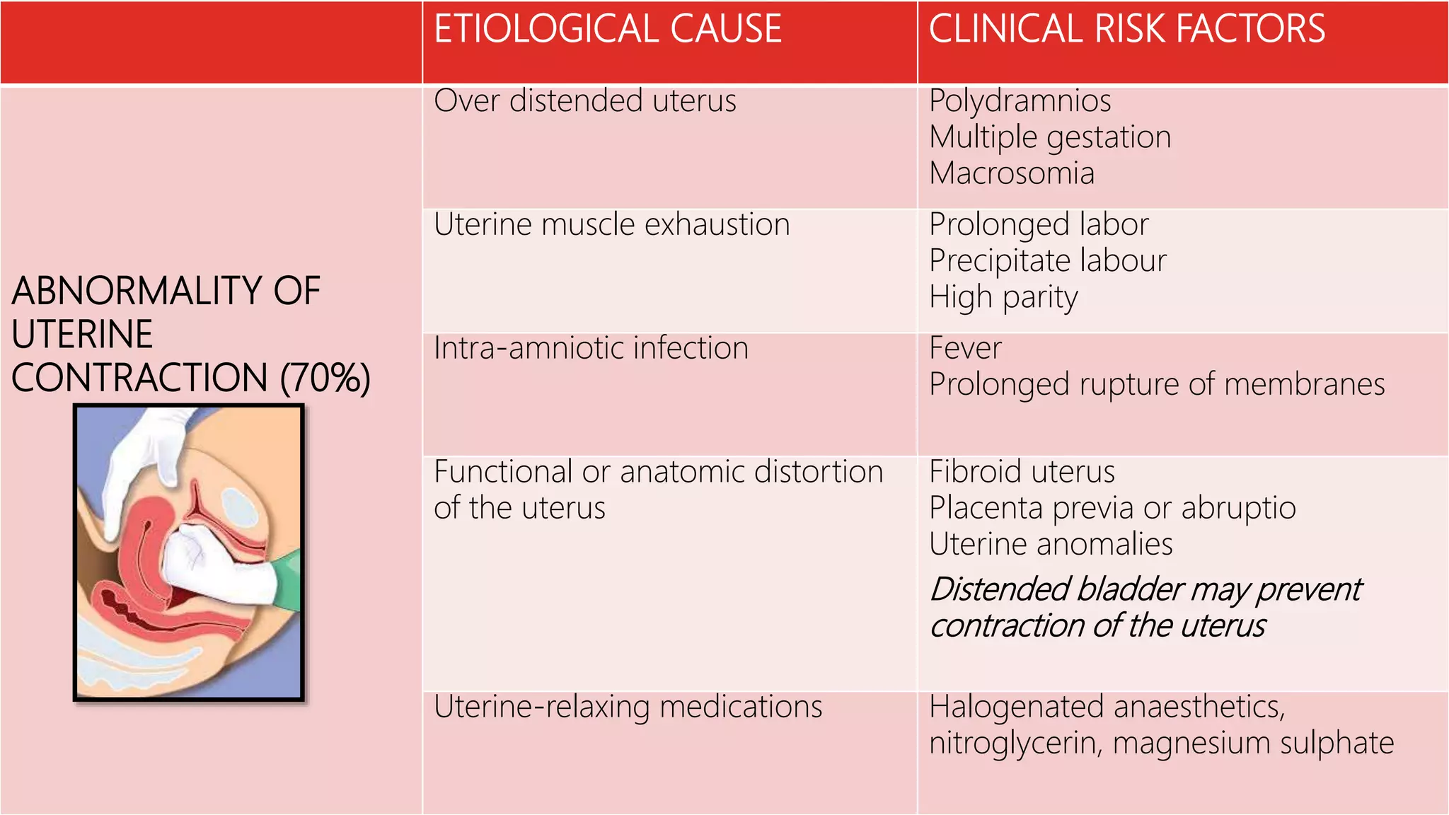 Step wise pelvic devascularisation | PPTX