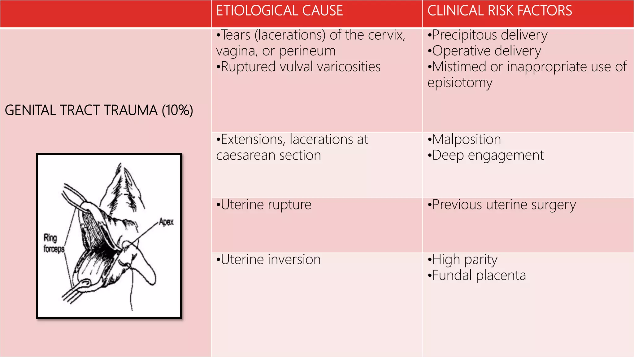 Step wise pelvic devascularisation | PPTX