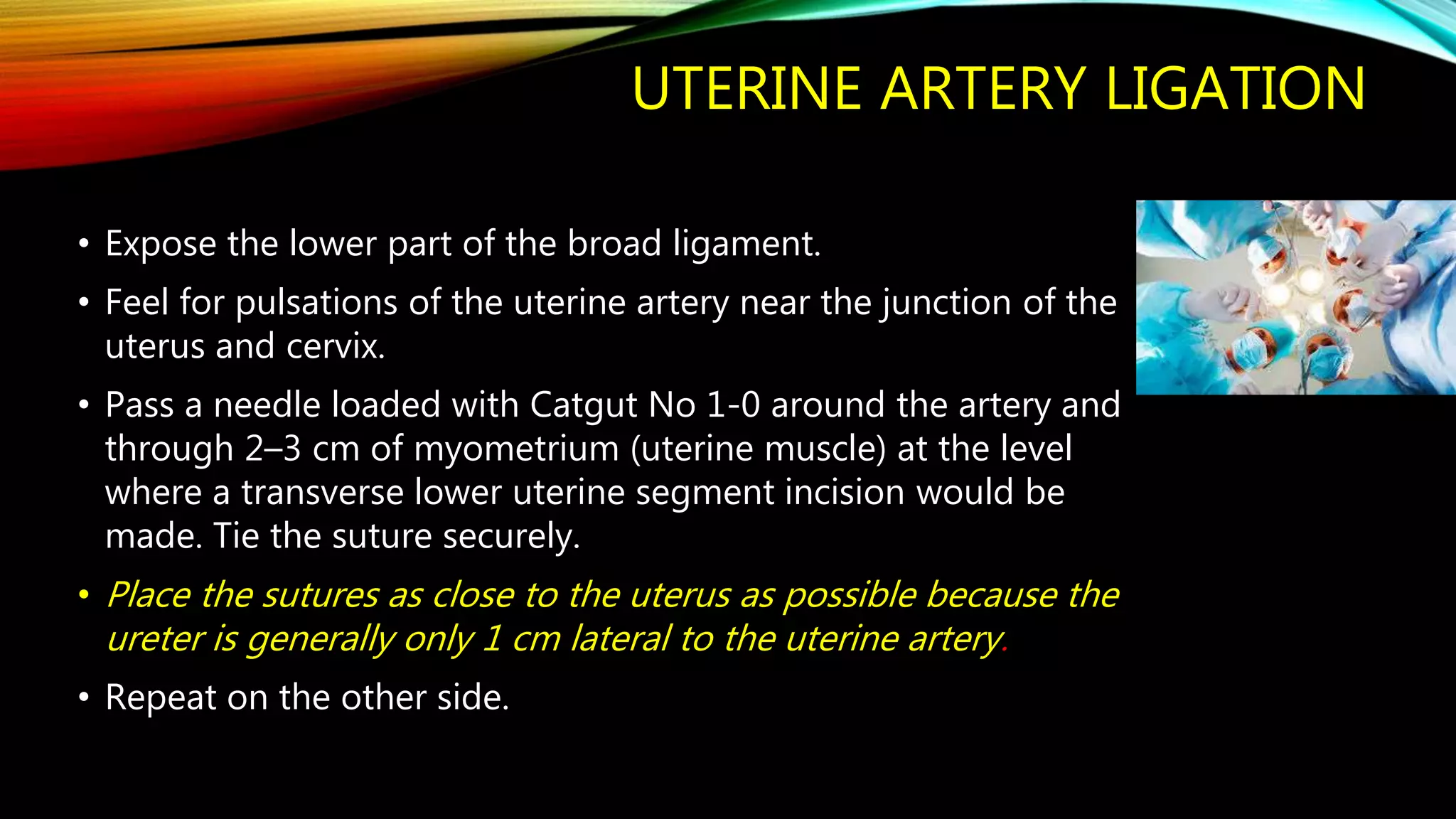 Step wise pelvic devascularisation | PPTX