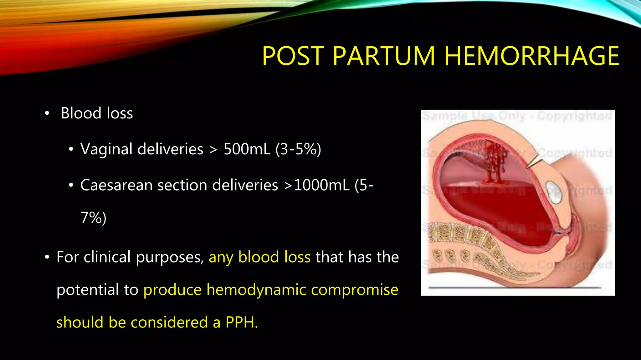 Step wise pelvic devascularisation | PPTX