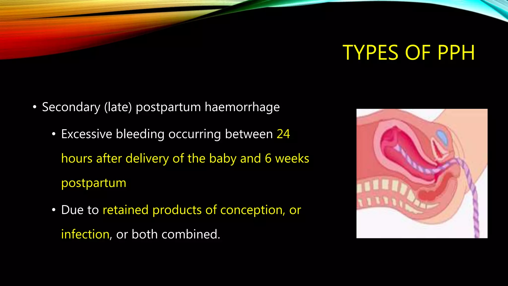 Step wise pelvic devascularisation | PPTX