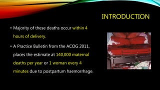 Step wise pelvic devascularisation | PPTX