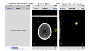 StereoCheck, StereoCheckRM, and CheckBRW - Stereotactic Coordinates ...