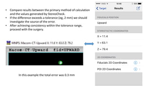 StereoCheck, StereoCheckRM, and CheckBRW - Stereotactic Coordinates ...