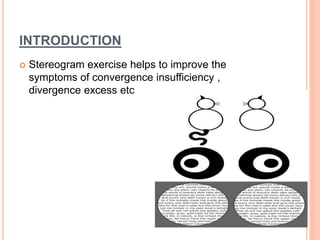 Stereograms vergence therapy | PPTX